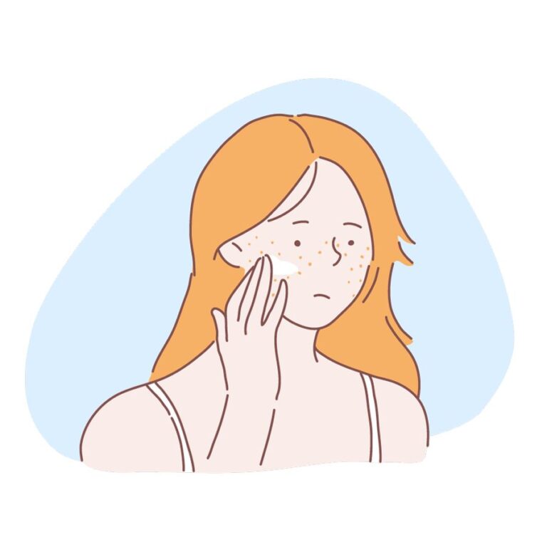 The Science of How Acne Form - Dermatology Sense